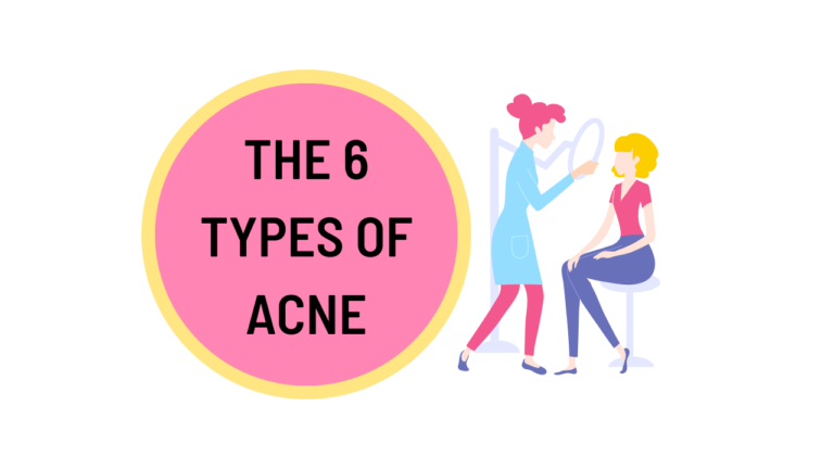 The 6 Types of Acne: How to Tell If Your Acne Is Mild, Moderate, or ...